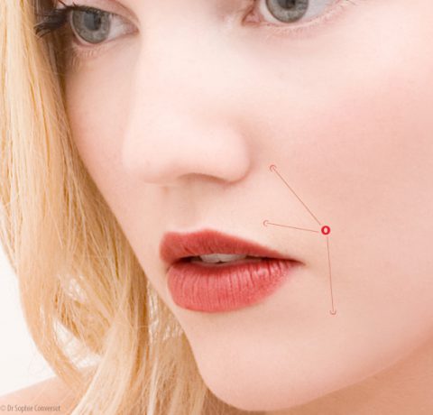 Le Sillon Naso-Génien - Docteur Converset Viethel